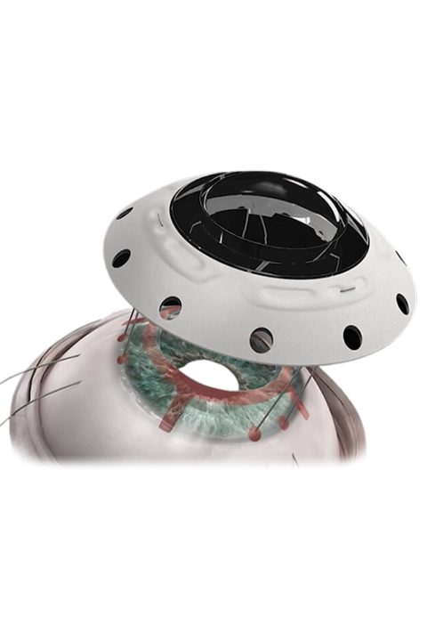 Ophthalmic Equipment & Surgical Instruments | Spectrum Surgical